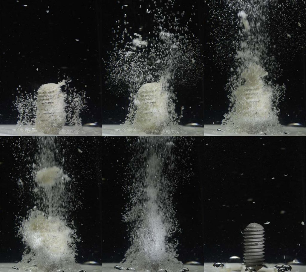 Periimplantitis-Therapie Jena | Galvosurge